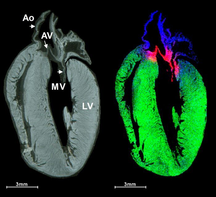 MS imaging of collagen may help heart attack patients | Spectroscopy ...